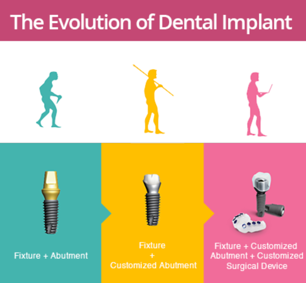 Digital Dental Implant - Gosford Dental Excellence